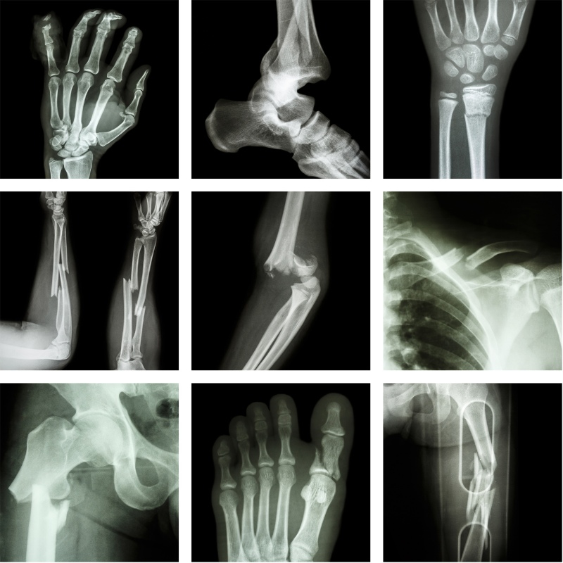 Orthopedic & Fracture Clinic In San Jose | Dr. Pamela Mehta