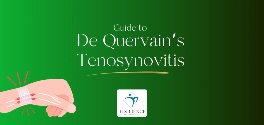 De Quervain’s Tenosynovitis Treatment In San Jose | Dr Mehta
