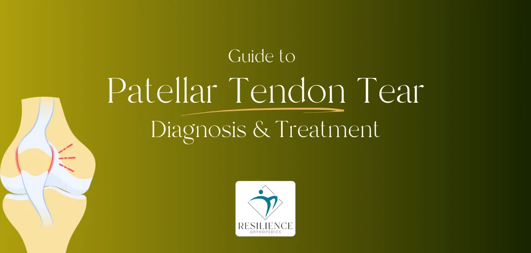 Patellar Tendon Tear Treatment In San Jose | Dr Pamela Mehta