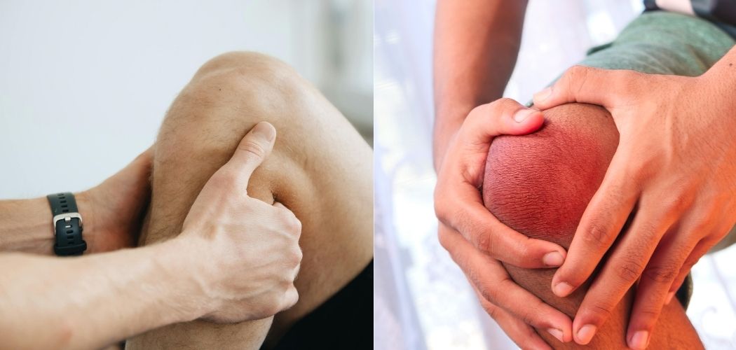 Is Knee Clicking Harmless Or A Red Flag? | Dr. Pamela Mehta, MD