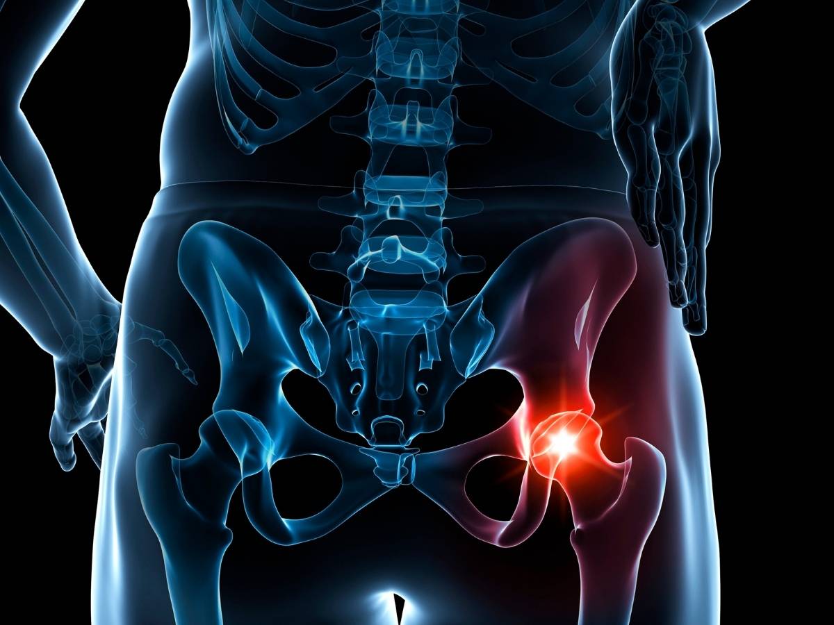 Why Do Your Hips Hurt During Menopause? I Dr. Pamela Mehta