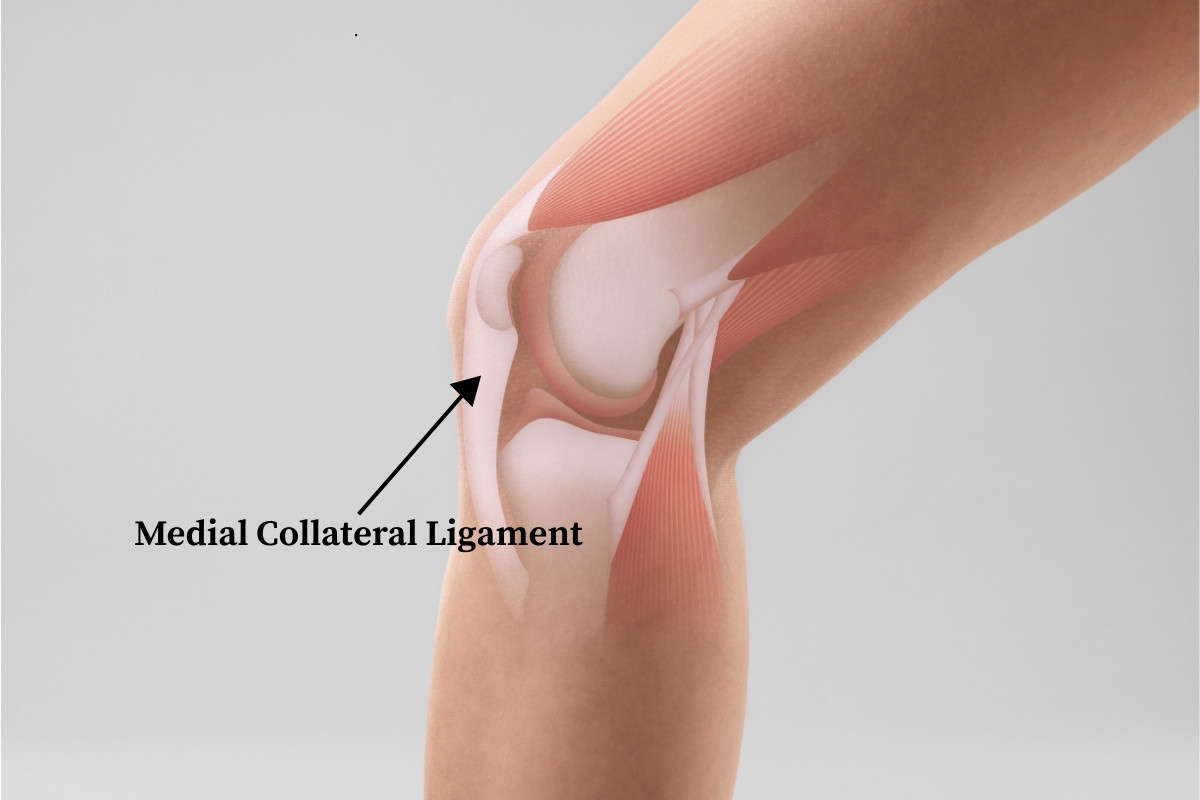 MCL Tear Treatment In San Jose | Dr. Pamela Mehta